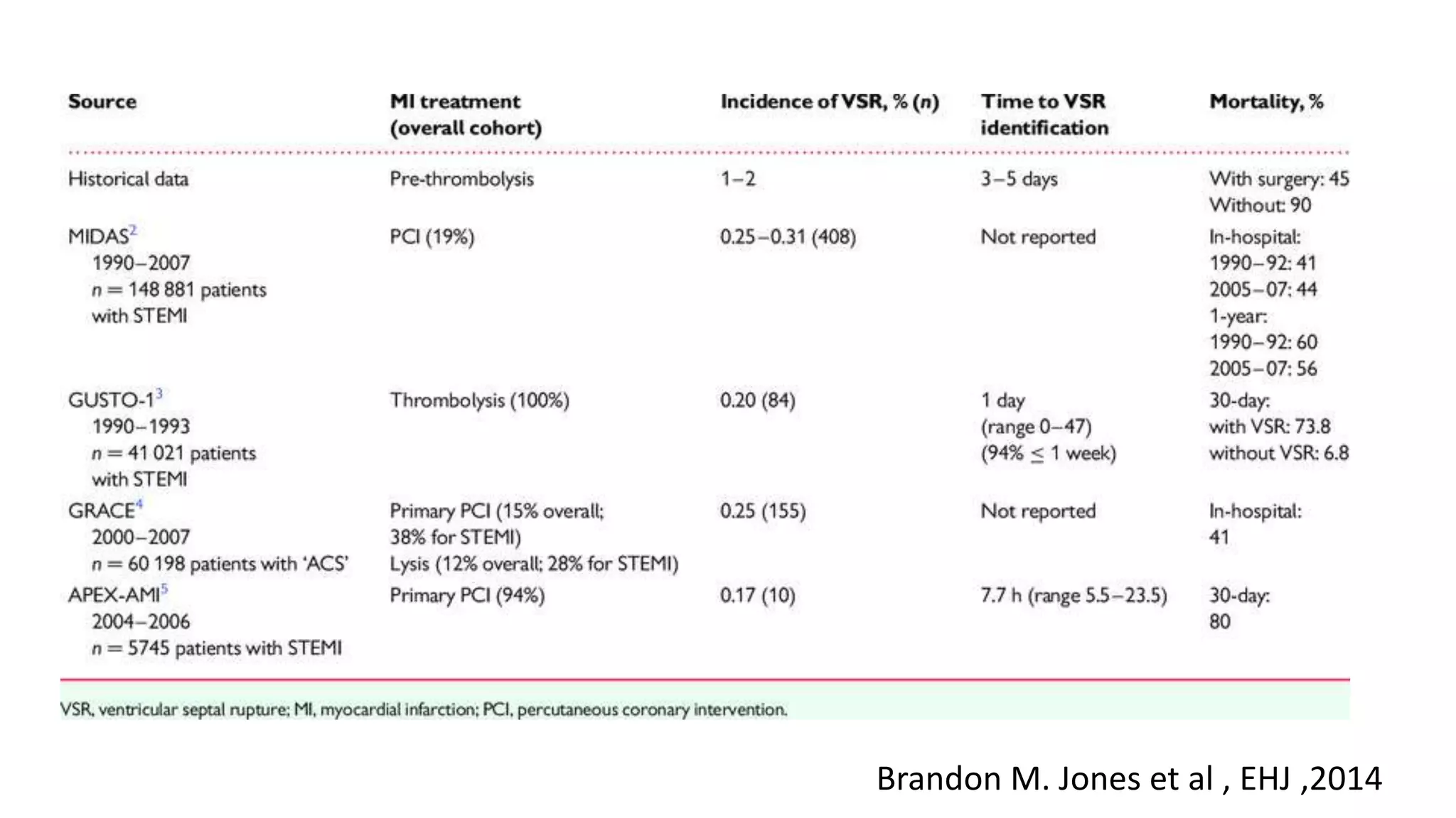 Ventricular septal rupture with cardiogenic shock follows by Inferior ...