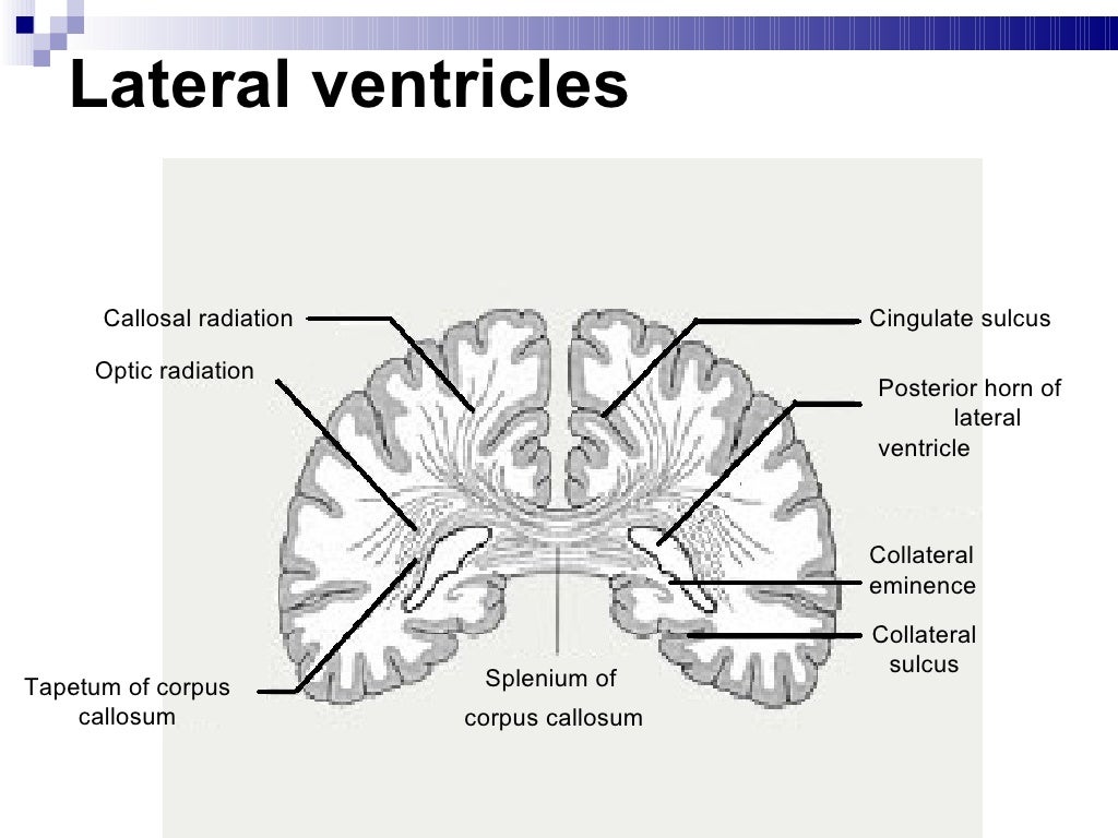 4 Ventricles Of The Brain