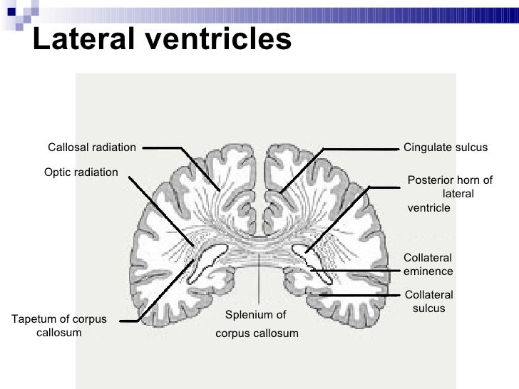 Ventricular system of brain final