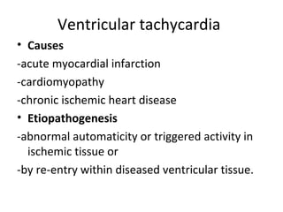 Ventricular tachyarrhythmias | PPT