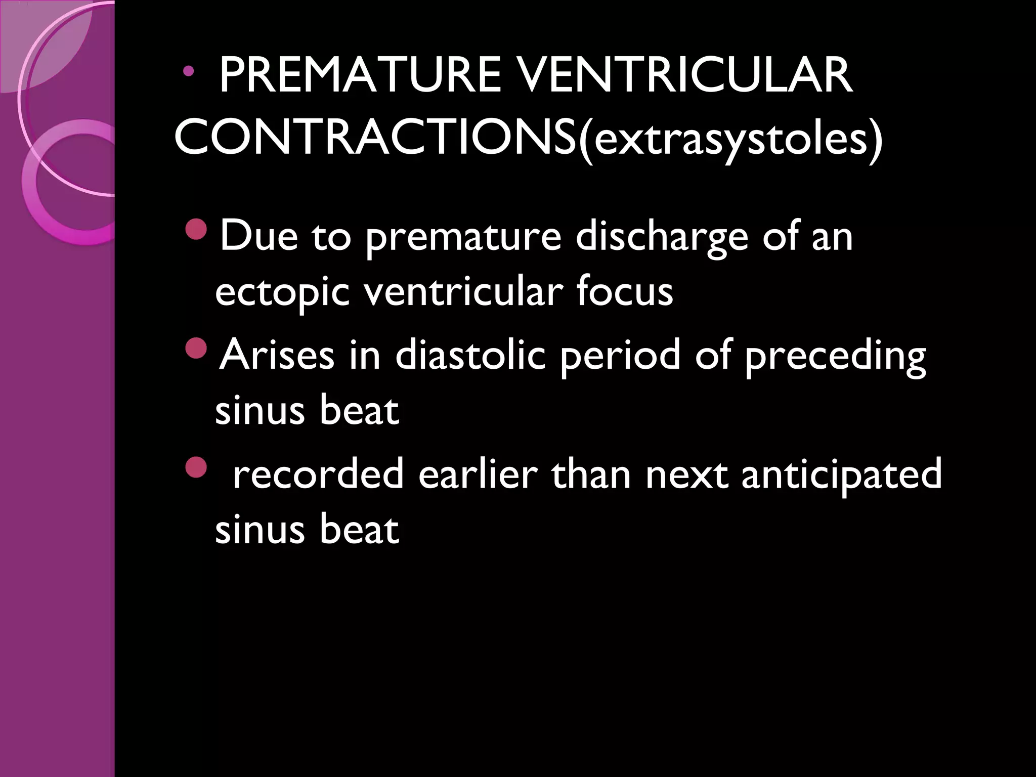 Ventricular tachyarrhythmias | PPT