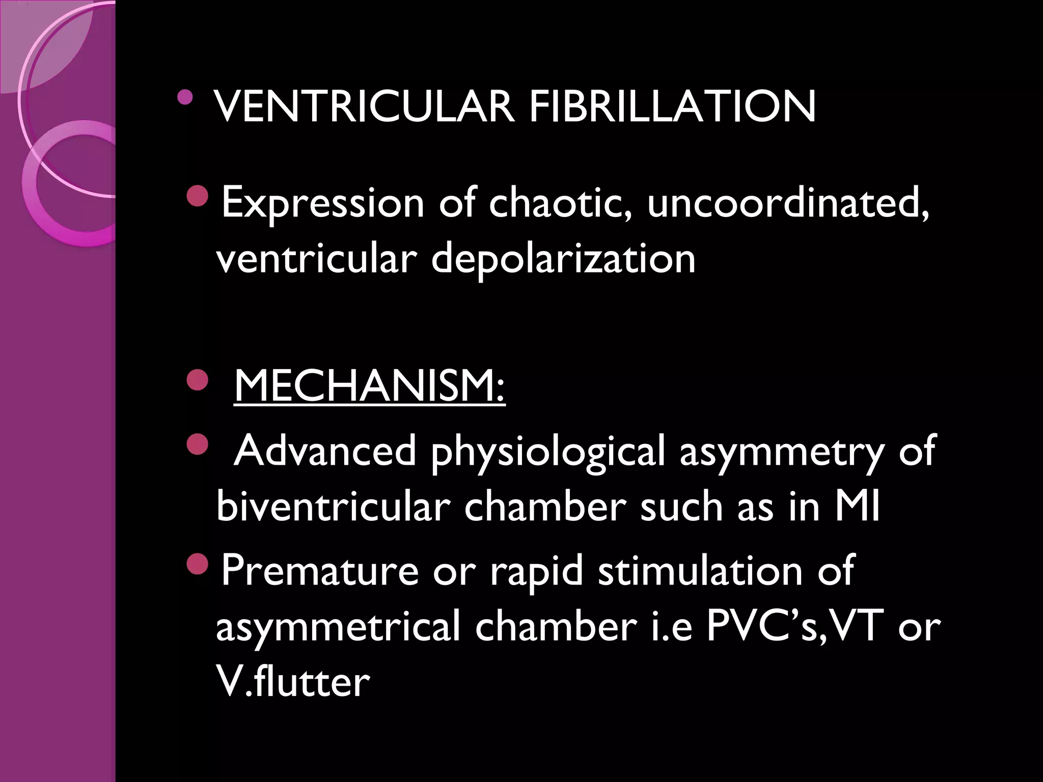 Ventricular tachyarrhythmias | PPT