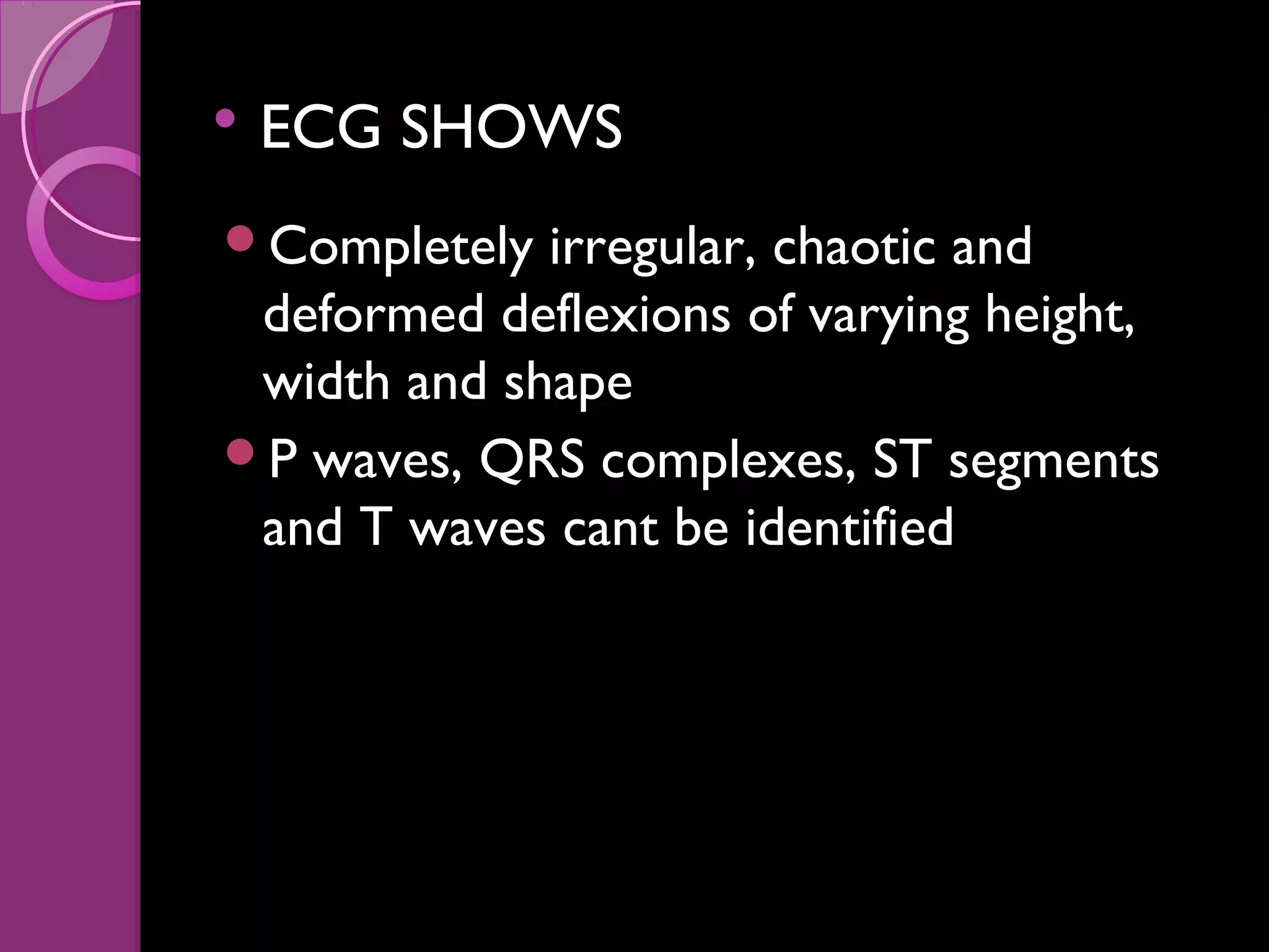 Ventricular tachyarrhythmias | PPT