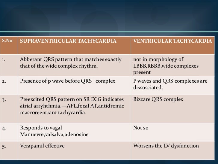 Ventricular Tachycardia Causes Diagnosis And Treatment