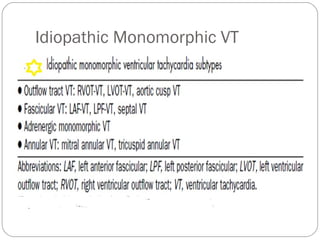 Ventricular tachycardia | PPT
