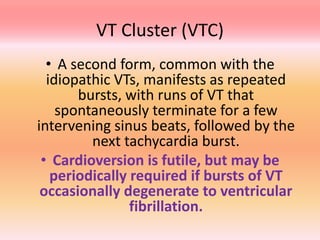 Ventricular tachycardia | PPT