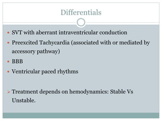 Ventricular tachycardia | PPT