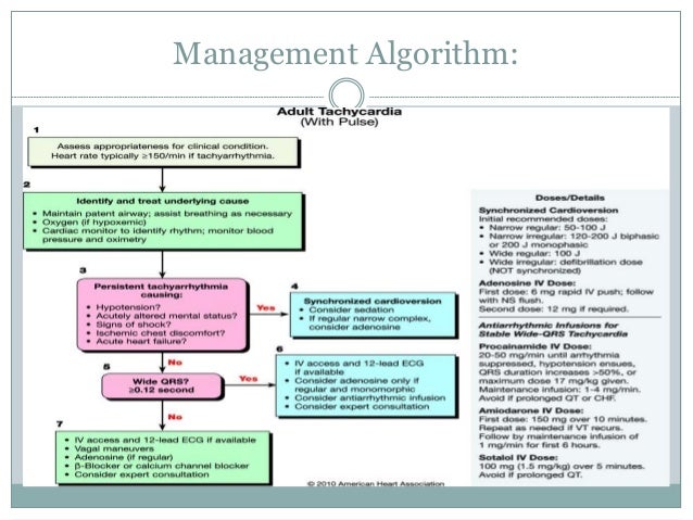 Ventricular tachycardia