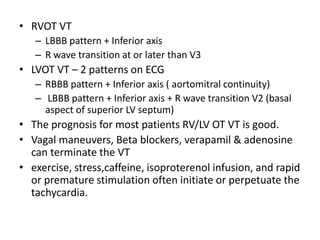Ventricular tachycardia | PPTX