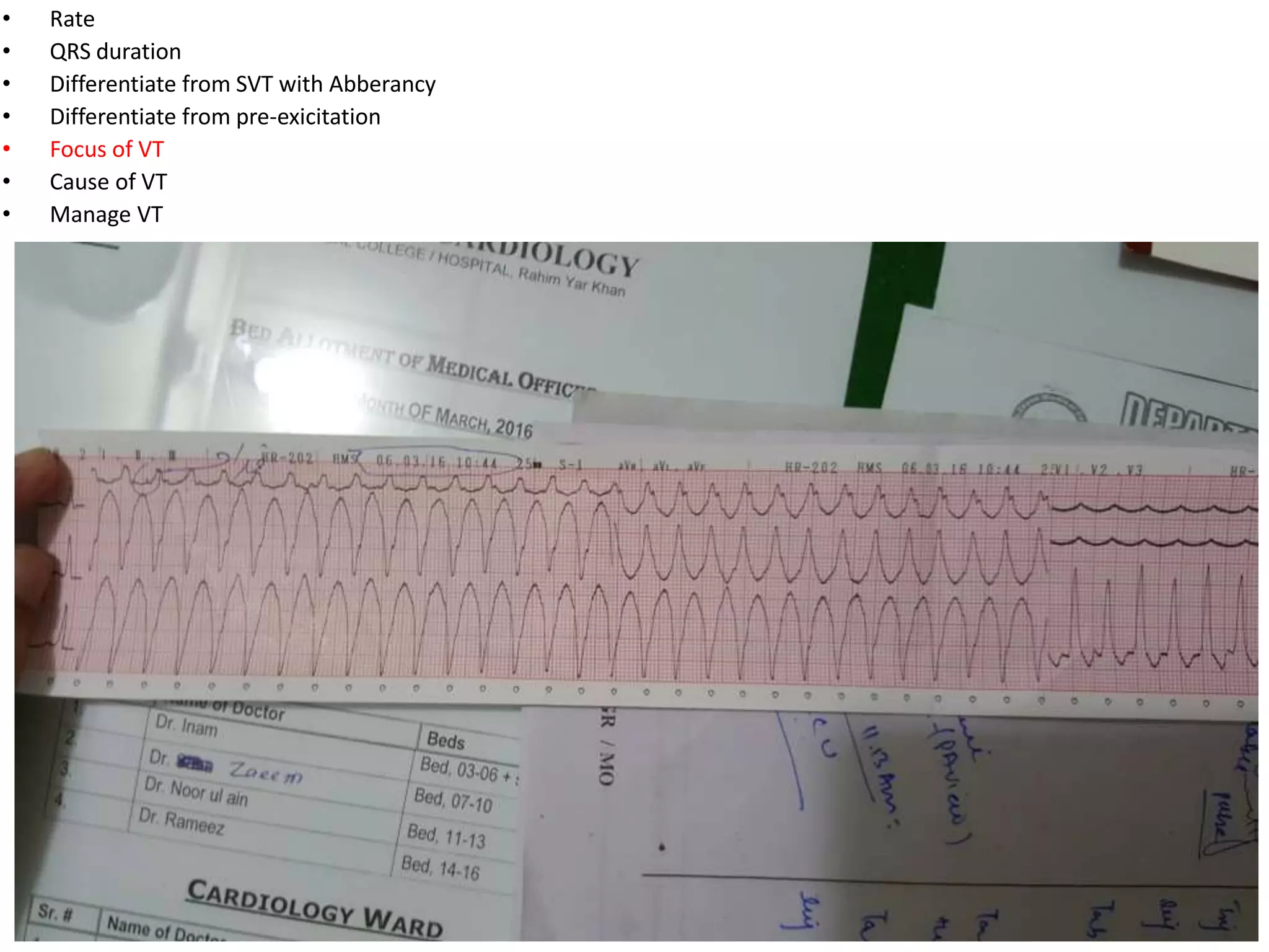 Ventricular tachycardia | PPTX