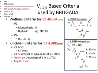 Ventricular tachycardia | PPTX