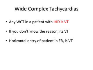 Ventricular tachycardia | PPTX