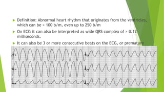 VENTRICULAR TACHYCARDIA..............pptx