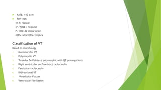VENTRICULAR TACHYCARDIA..............pptx