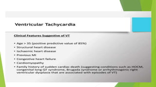 VENTRICULAR TACHYCARDIA..............pptx