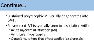 Ventricular tachycardia Essential topic.pptx