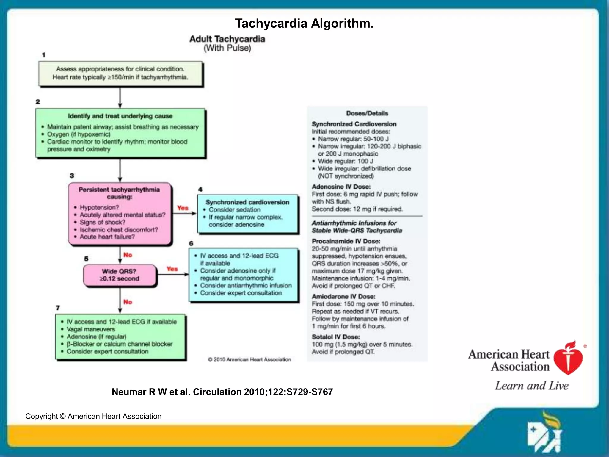Ventricular tachycardia | PPTX