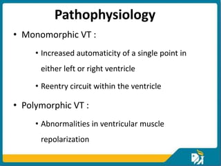 Ventricular tachycardia | PPTX