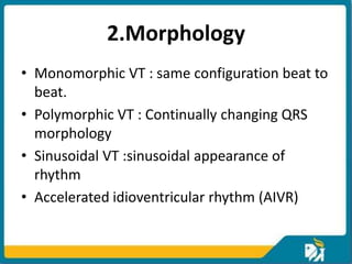 Monomorphic Vs Polymorphic Ventricular Tachycardia