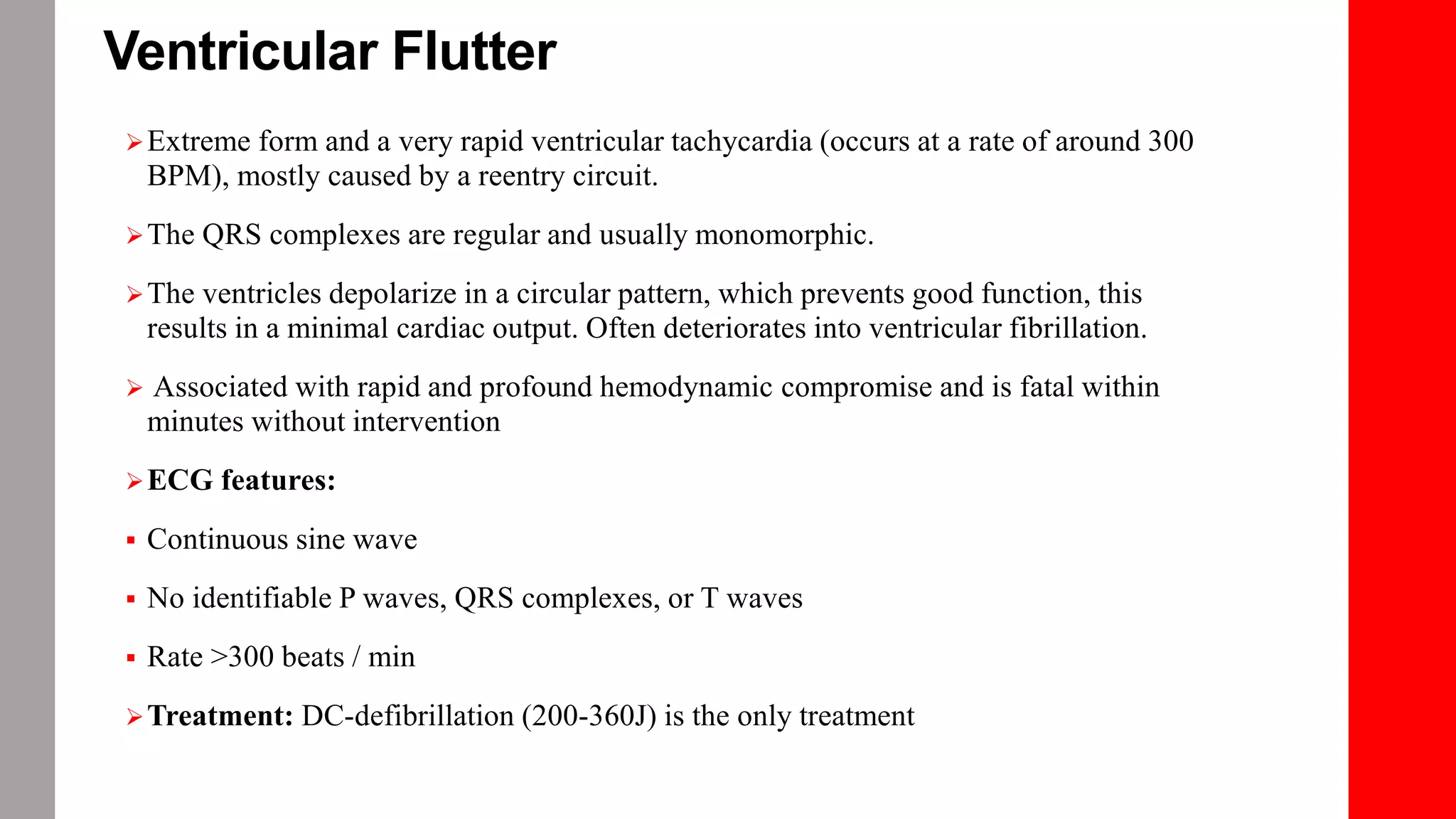 Ventricular tachycardia, ventricular flutter, and ventricular ...
