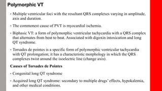 Ventricular tachycardia, ventricular flutter, and ventricular ...