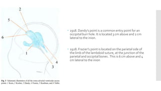 Anatomía de los Ventrículos laterales | PPT