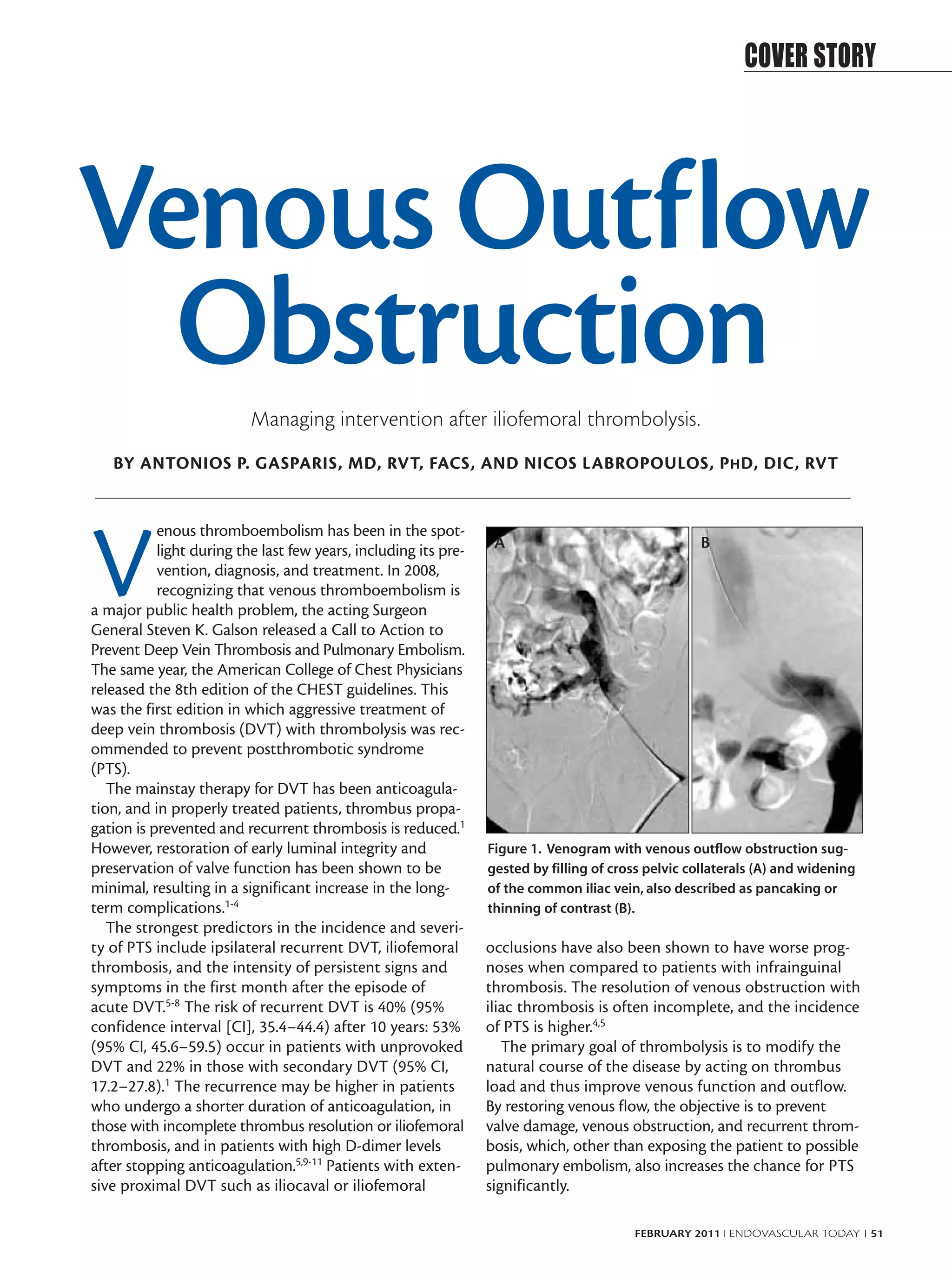 Venus obstructive outflow | PDF