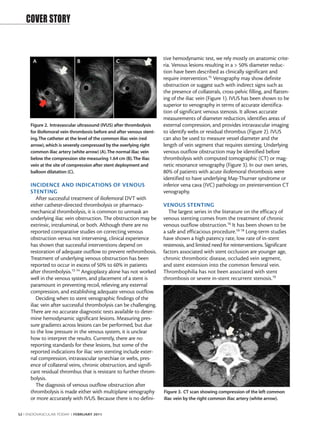 Venus obstructive outflow | PDF