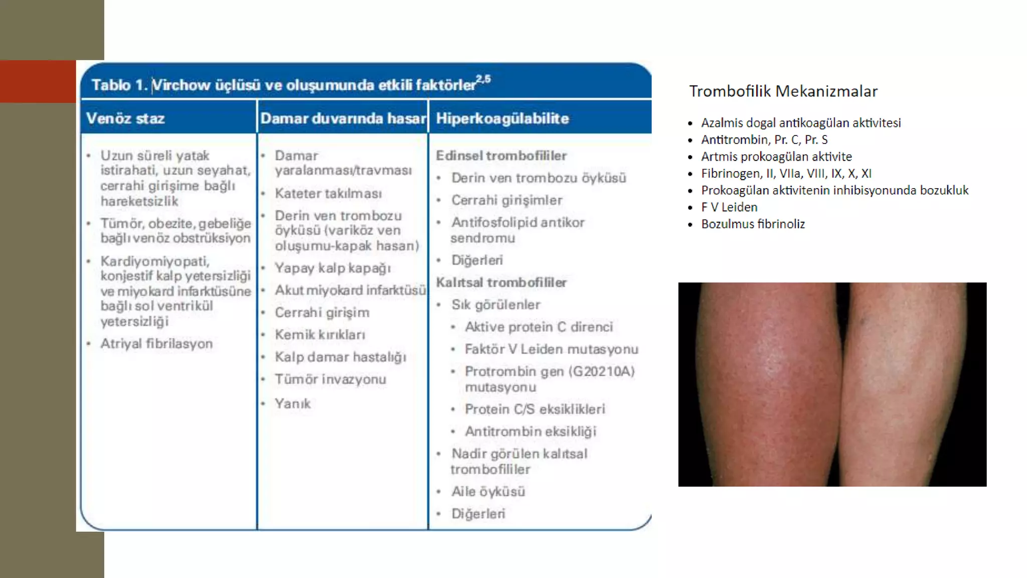Venöz Tromboembolizm.pptx