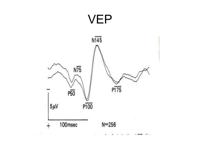V isual evoked potentials