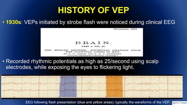 Intraoperative Flash Visual Evoked Potentials | PPT