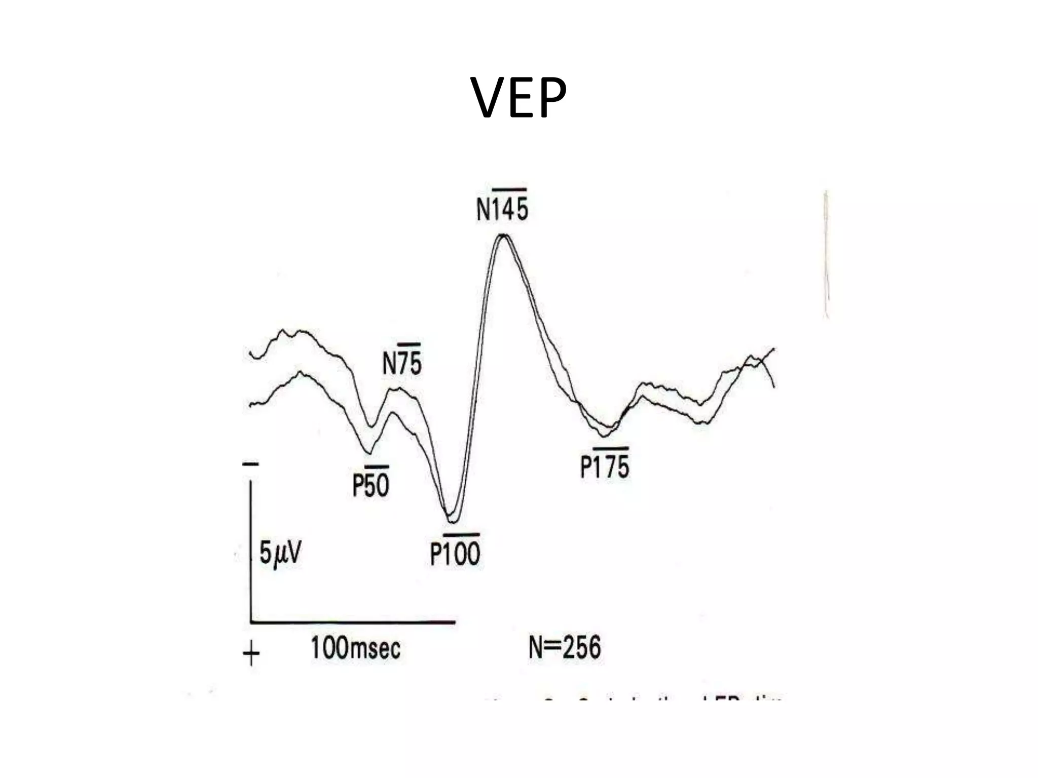 Vep and its practical importance | PPT