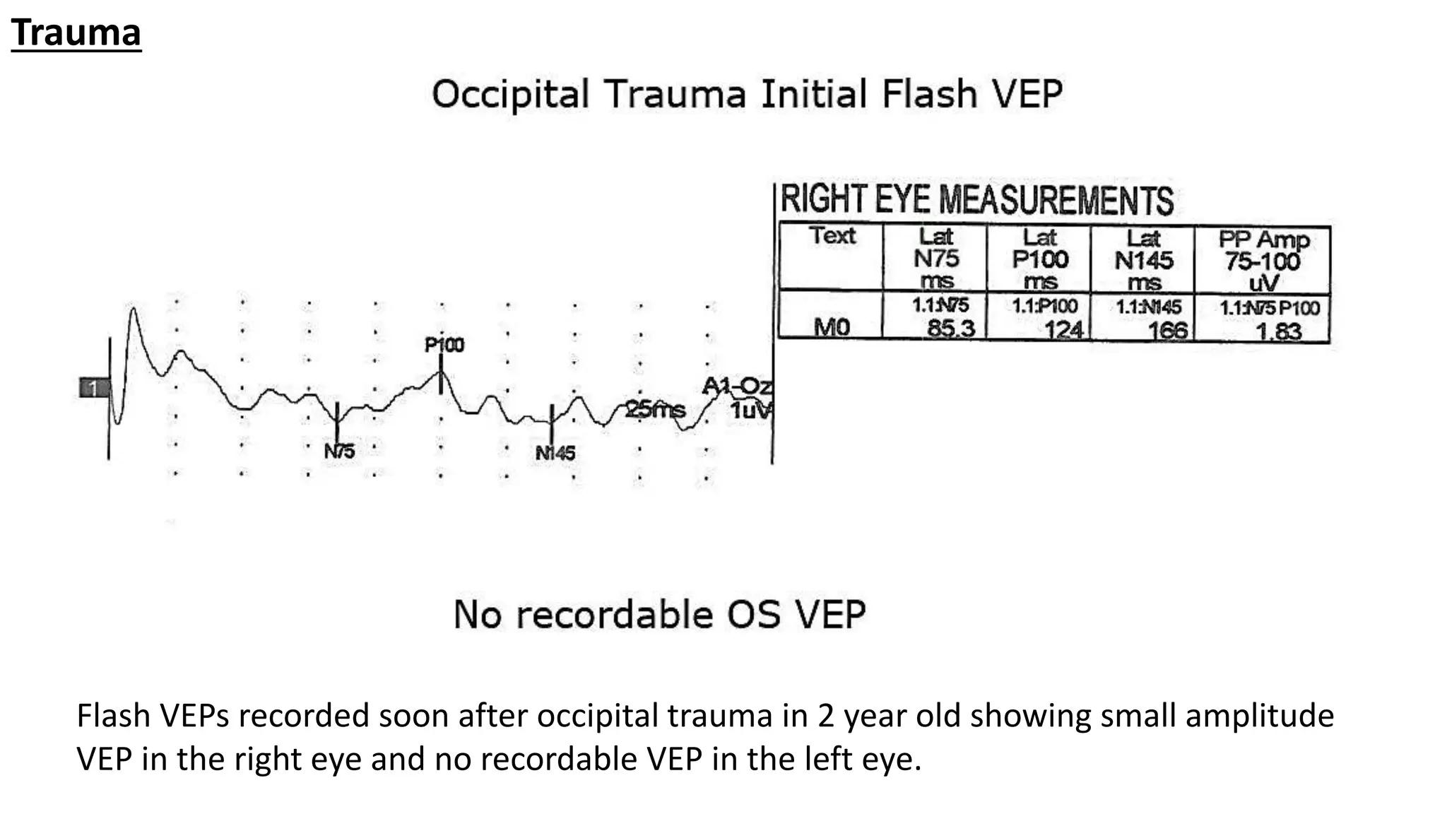 Visual Evoked Potential | PPTX