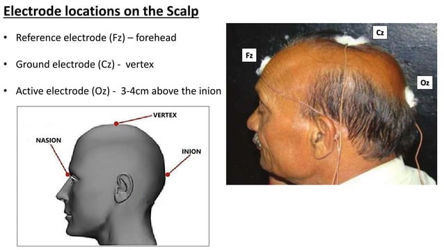 Visual Evoked Potential | PPTX