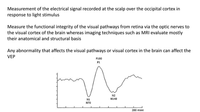 Visual Evoked Potential | PPTX