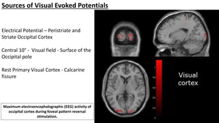 Visual Evoked Potential | PPTX