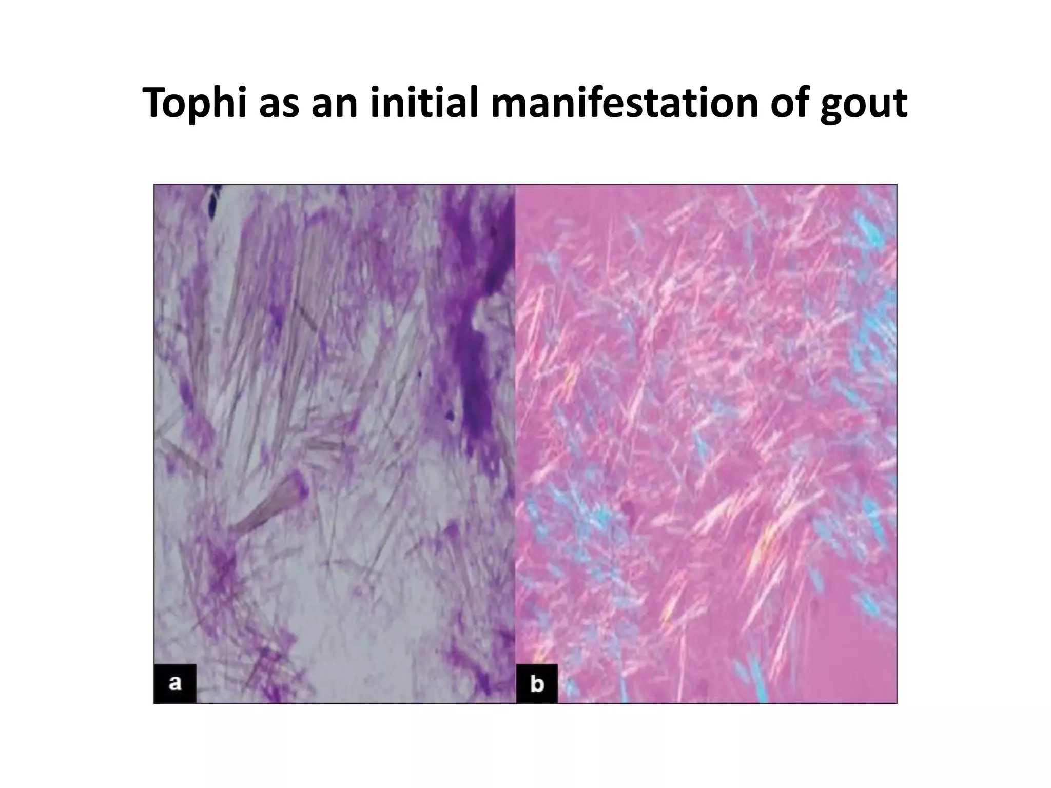 Polarizing Light Microscopy | PPTX