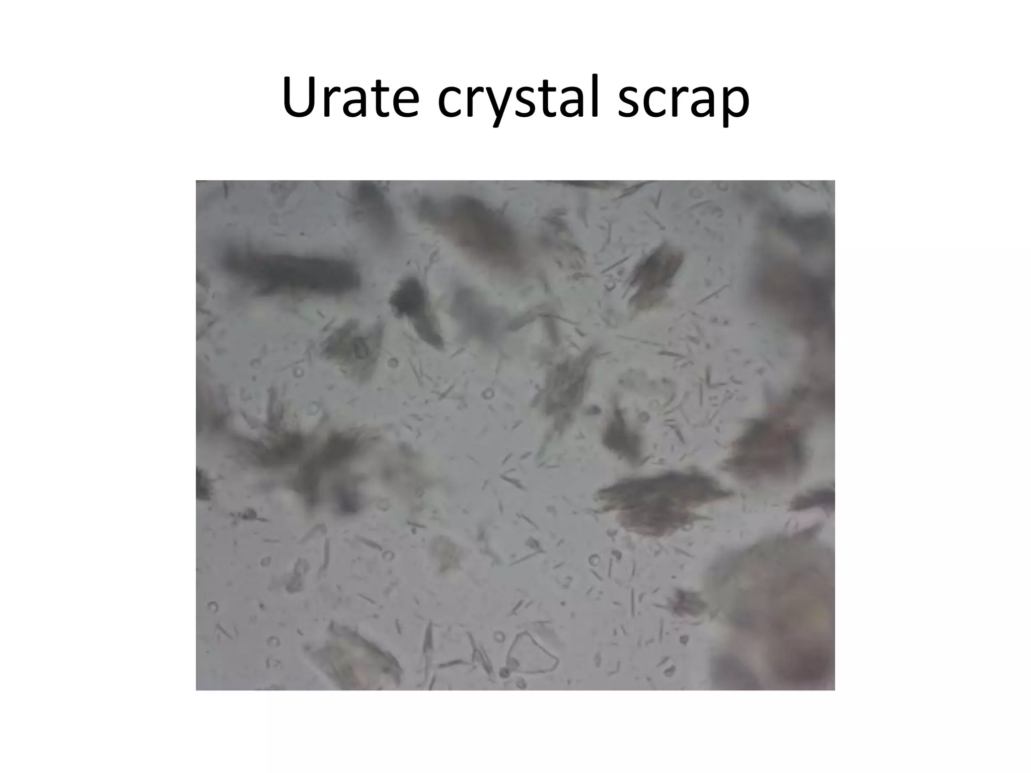 Polarizing Light Microscopy | PPTX