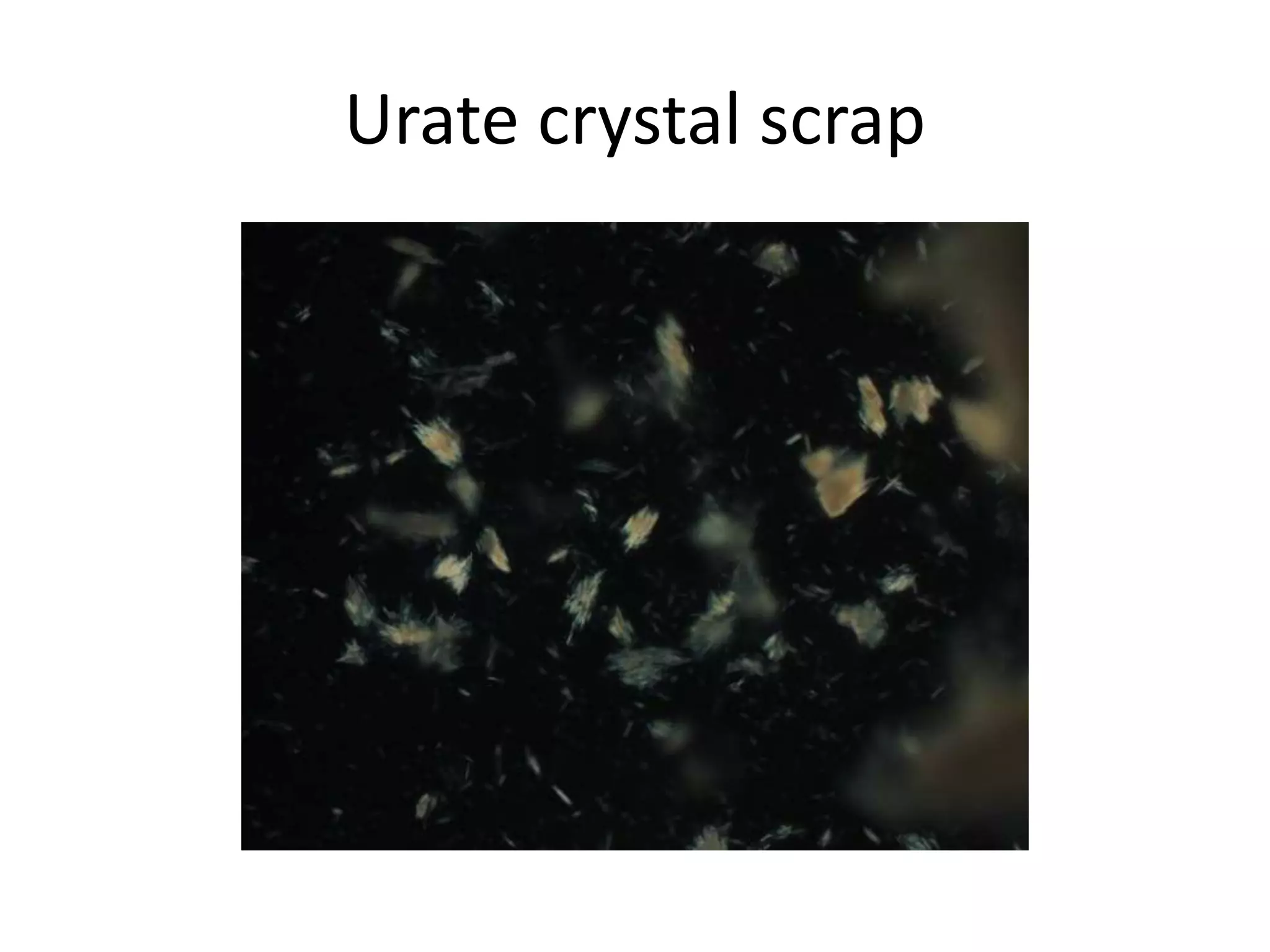 Polarizing Light Microscopy | PPTX