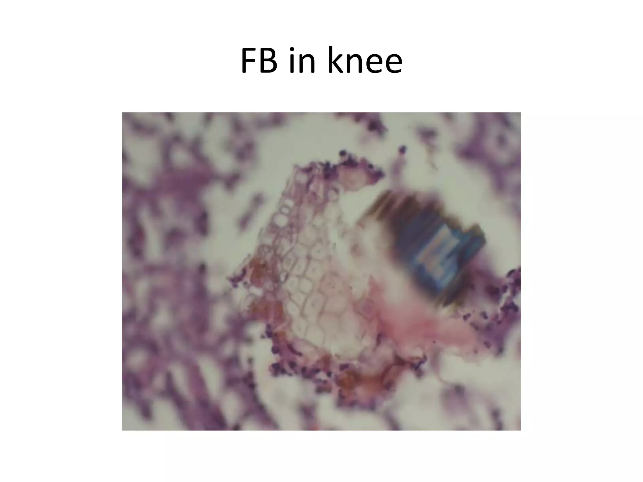 Polarizing Light Microscopy | PPTX