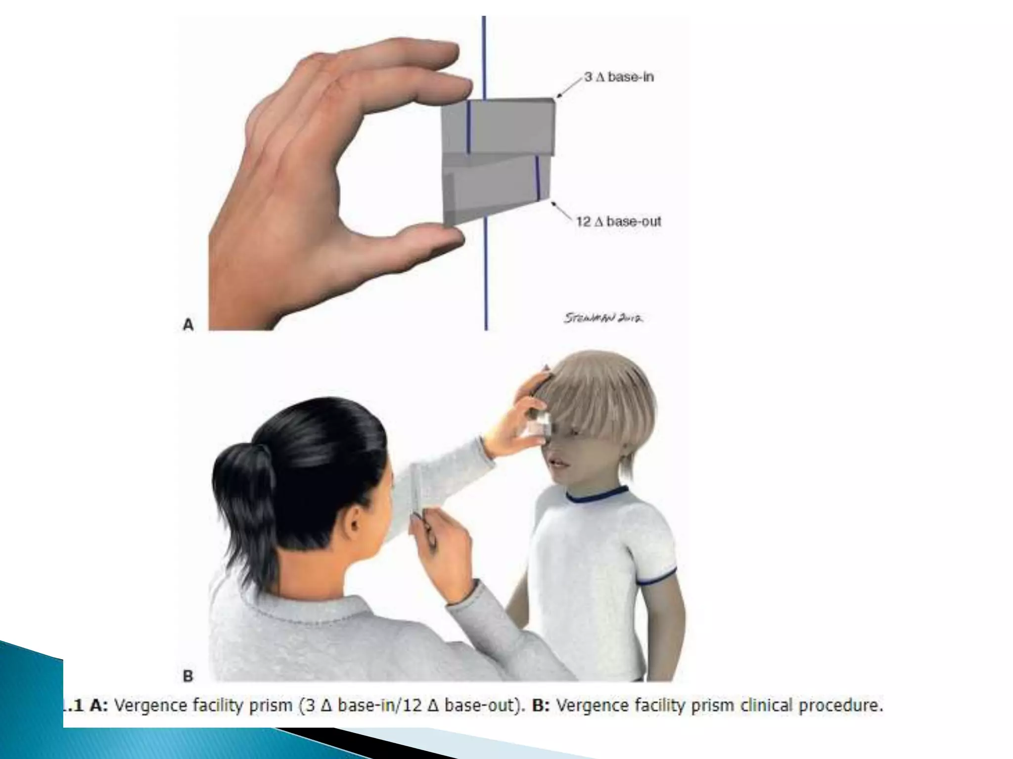 Vergence Facility Testing.pptx