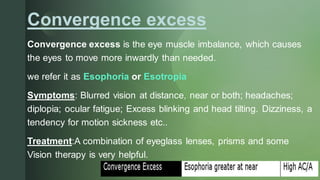 Vergence and its anomalies | PDF