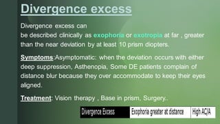 Vergence and its anomalies | PDF