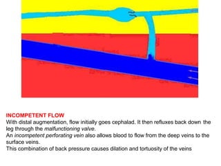 Duplex ultrasound of Vericose vein | PPTX