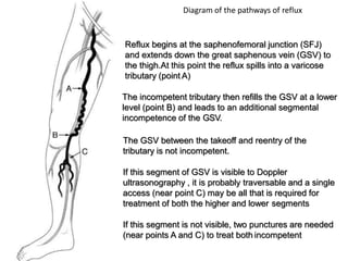 Duplex ultrasound of Vericose vein | PPTX