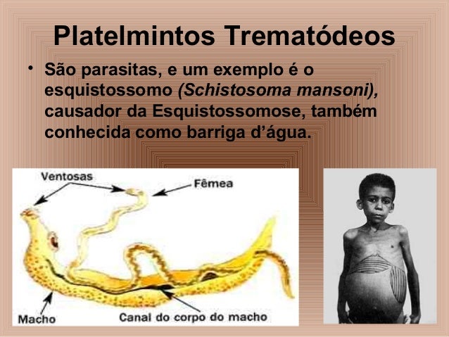 Parasitas Vermes Em Humanos