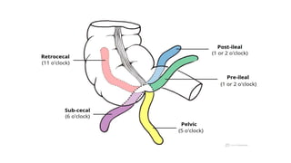 VERMIFORM APPENDIX.pptx