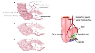 VERMIFORM APPENDIX in detai with surgical amangemntl.pptx