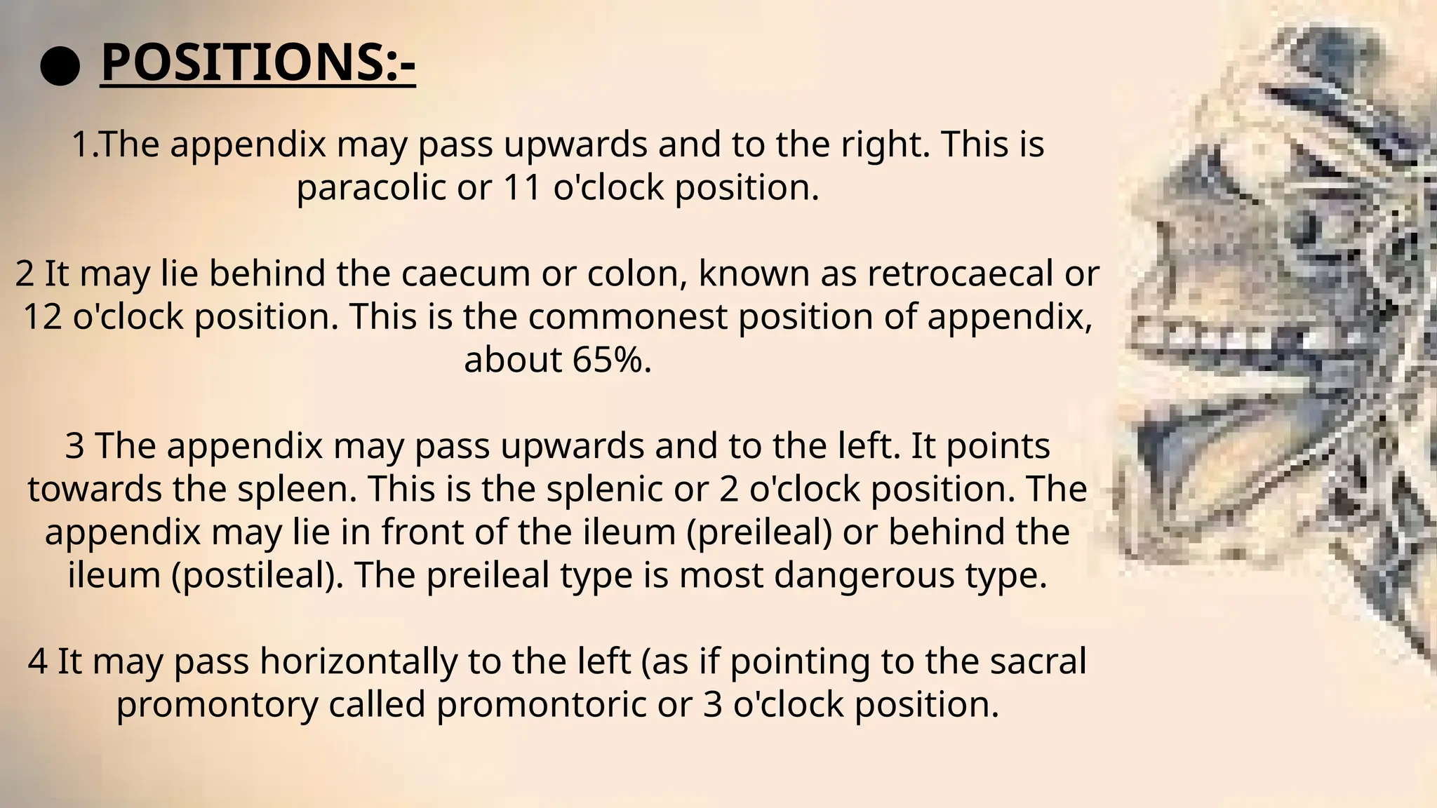 VERMIFORM APPENDIX (GP 10).pptx with detailed diagrams | PPTX