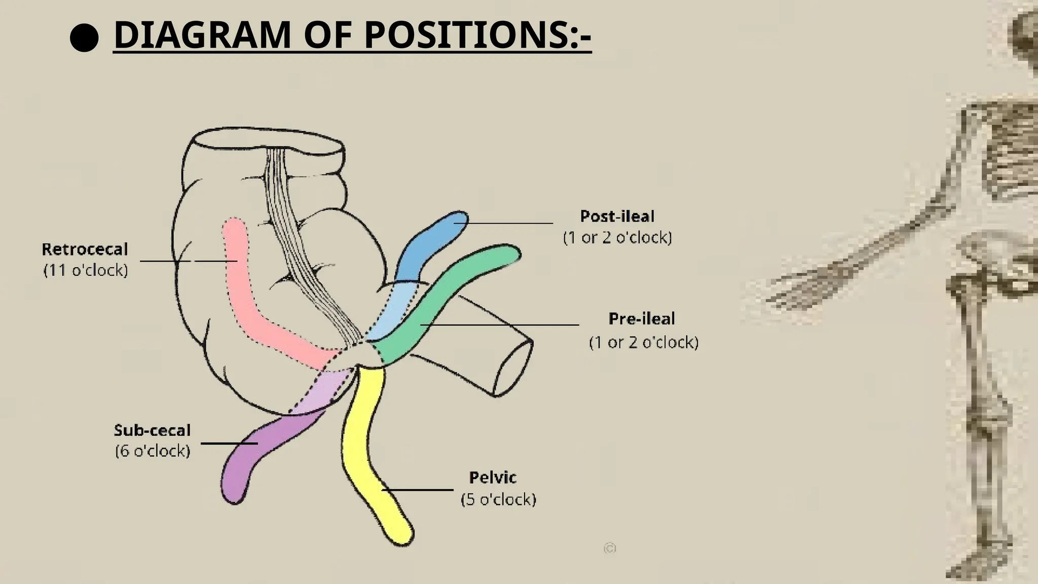 VERMIFORM APPENDIX (GP 10).pptx with detailed diagrams | PPTX